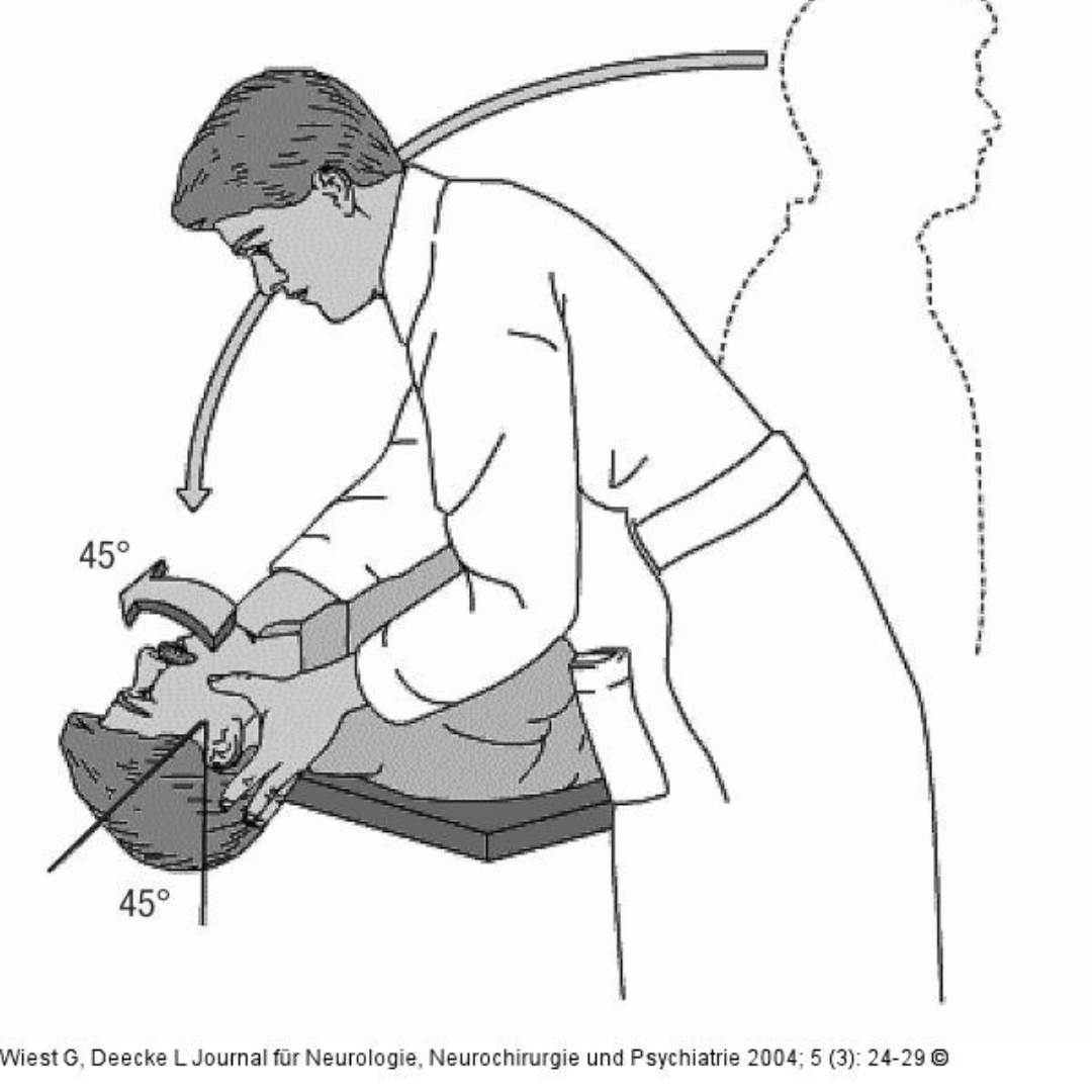 Vertigo/Vestibular Rehab